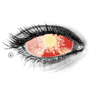 Blind Contacts Sclera Lenses